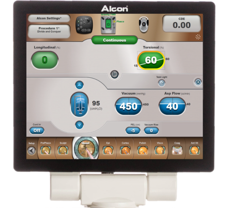 CENTURION Silver System | The Most Advanced Gravity System | MyAlcon | Egypt